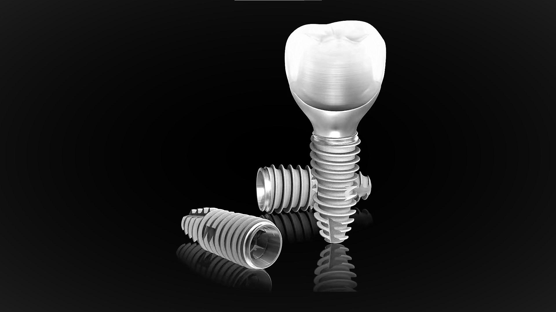 Корейські імпланти NeoBiotech (НеоБіотех) • Дніпро